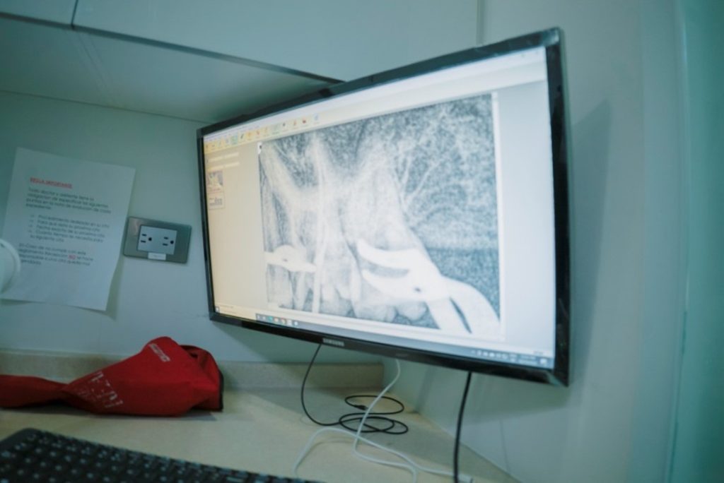 Discover teeth with a number of roots - Rubio Dental Group