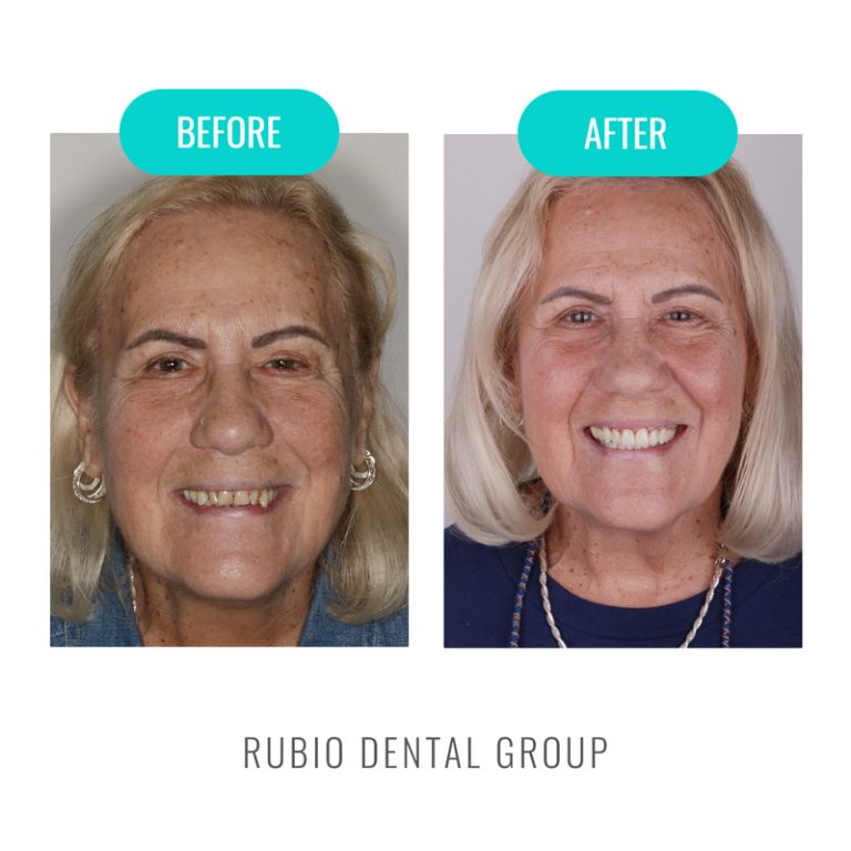 Dental Smiles: Best Transforming to the Extraordinary